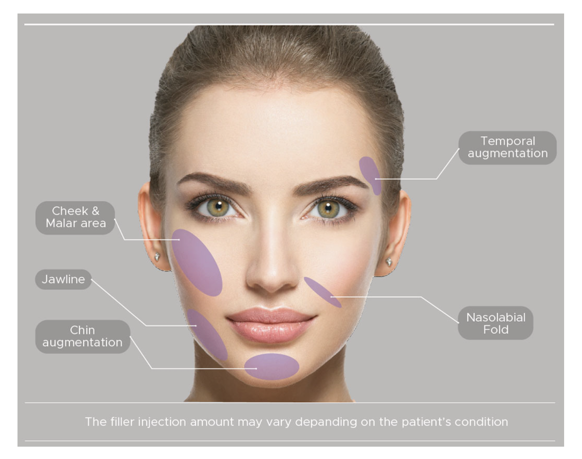 Buy Lafullen | |pcl Filler | Collagen Stimulator | Injectable from ...