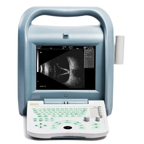 Buy Ophthalmic Ultrasound Ab Scan from Omni Well Industrial (Wuhan) Co ...