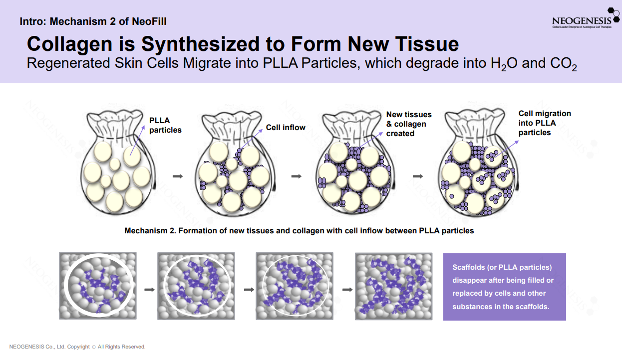 Buy [neogenesis] Neofill - (made In Korea) from NeoGenesis, South Korea ...