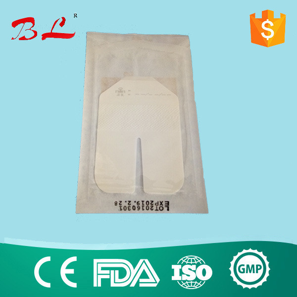 Buy Catheter Fix Pu Transparent Wound Dressing/hospital Supply ...