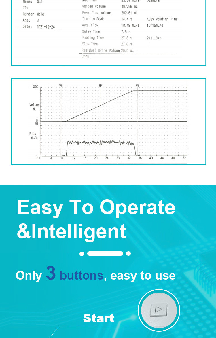 Buy Clinical Analytical Instruments Pc Series1100ml Normal Value Of Uroflowmetry For Bph Flow ...
