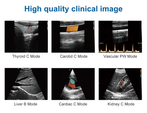 Buy Small Size Handheld Doppler Ultrasound Scanner Machine Ultrasonido ...