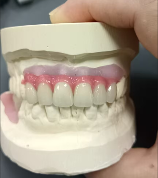 Buy Screw-retained Crowns & Bridges China Dental Lab from Shenzhen ...