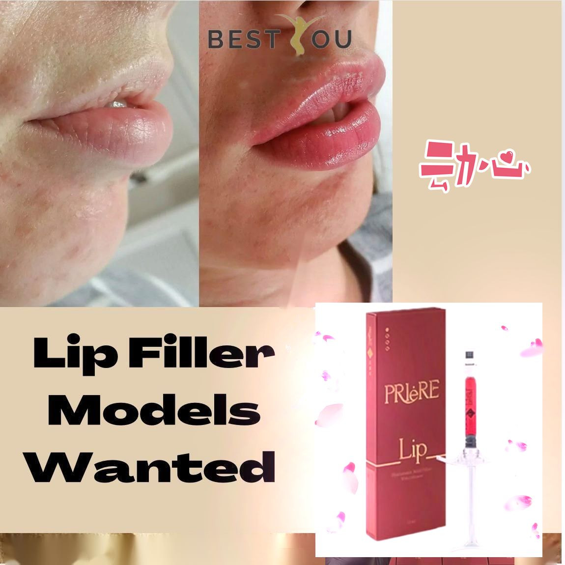 Buy Korea Popular Treatment Priere Lips Filler Hyaluronic Acid Dermal ...