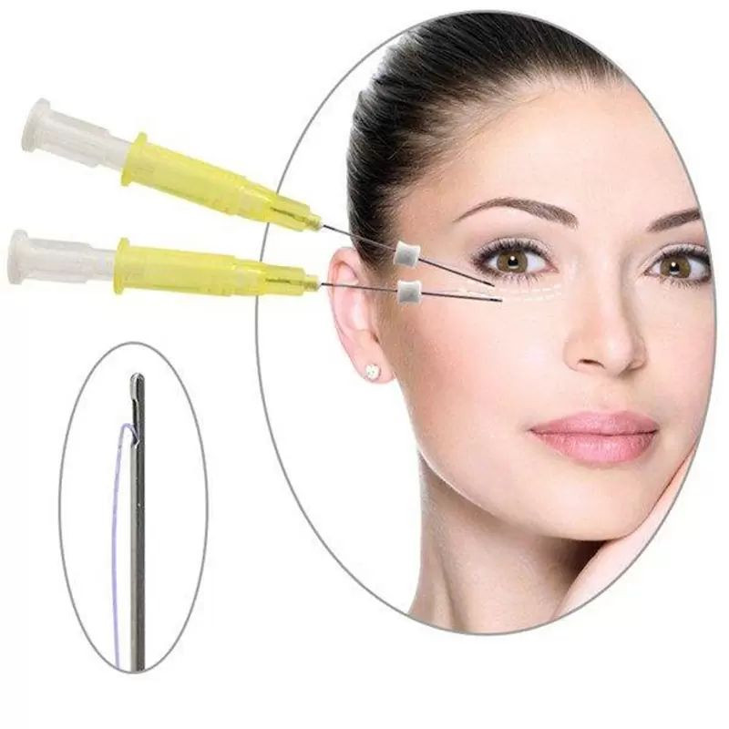 Buy Fish Bone Type Molding Cog Pcl Pdo Threads 18g Pdo Wires With Ce ...