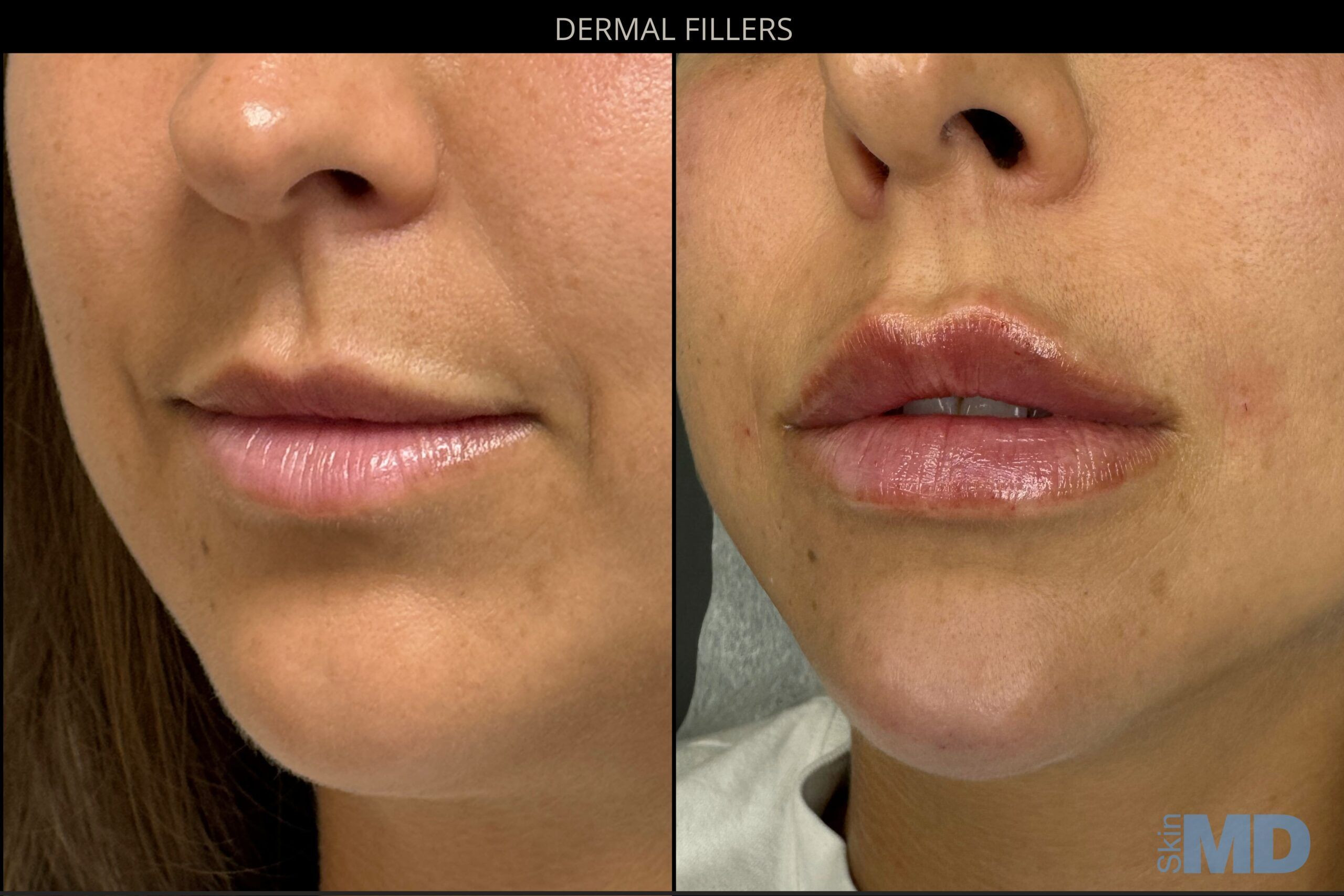 Buy Synthetic Peptide-based Fillers from TW Trade Co., Ltd, USA ...