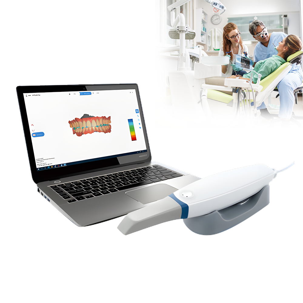 Buy 3d Intraoral Scanner Supplier from Joy Medical Supplies Co., Ltd ...