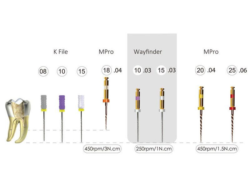 Buy Mpro Niti Files (3 Files System) from Innovative Material and ...