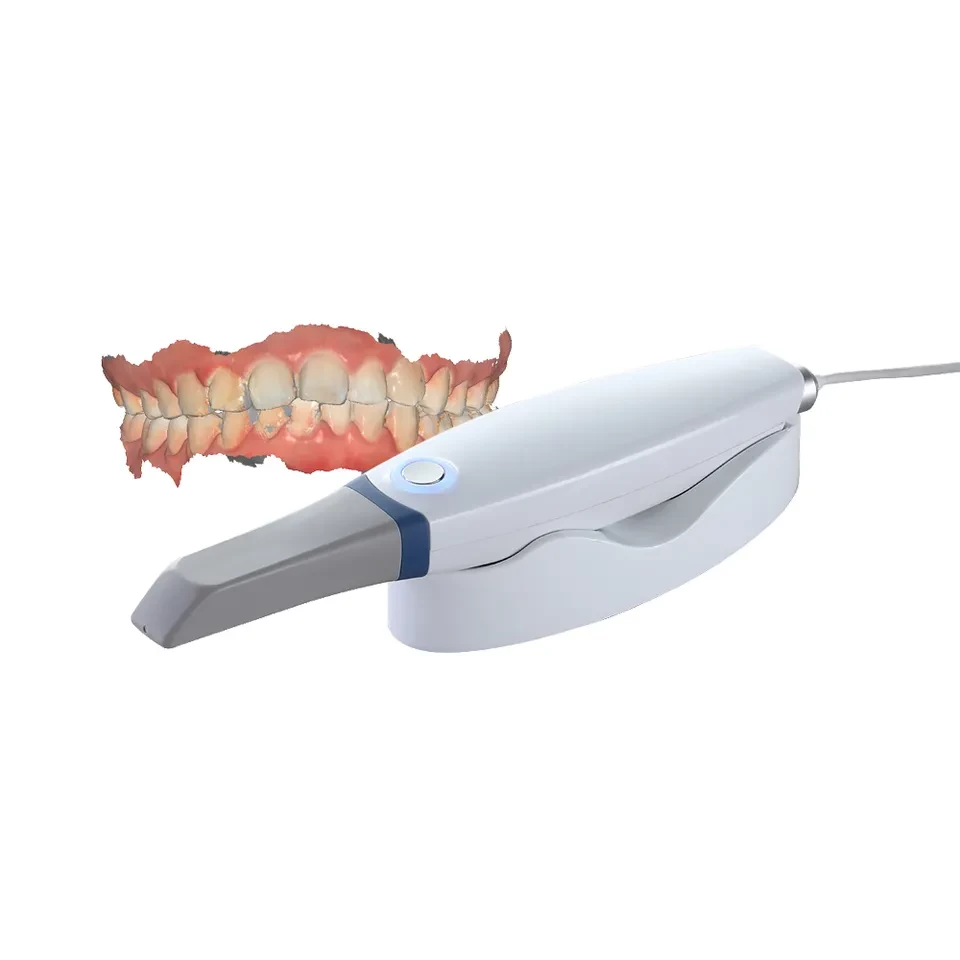 Buy 3d Intraoral Scanner Supplier from Joy Medical Supplies Co., Ltd ...