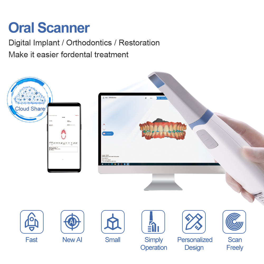 Buy 3d Intraoral Scanner Supplier from Joy Medical Supplies Co., Ltd ...