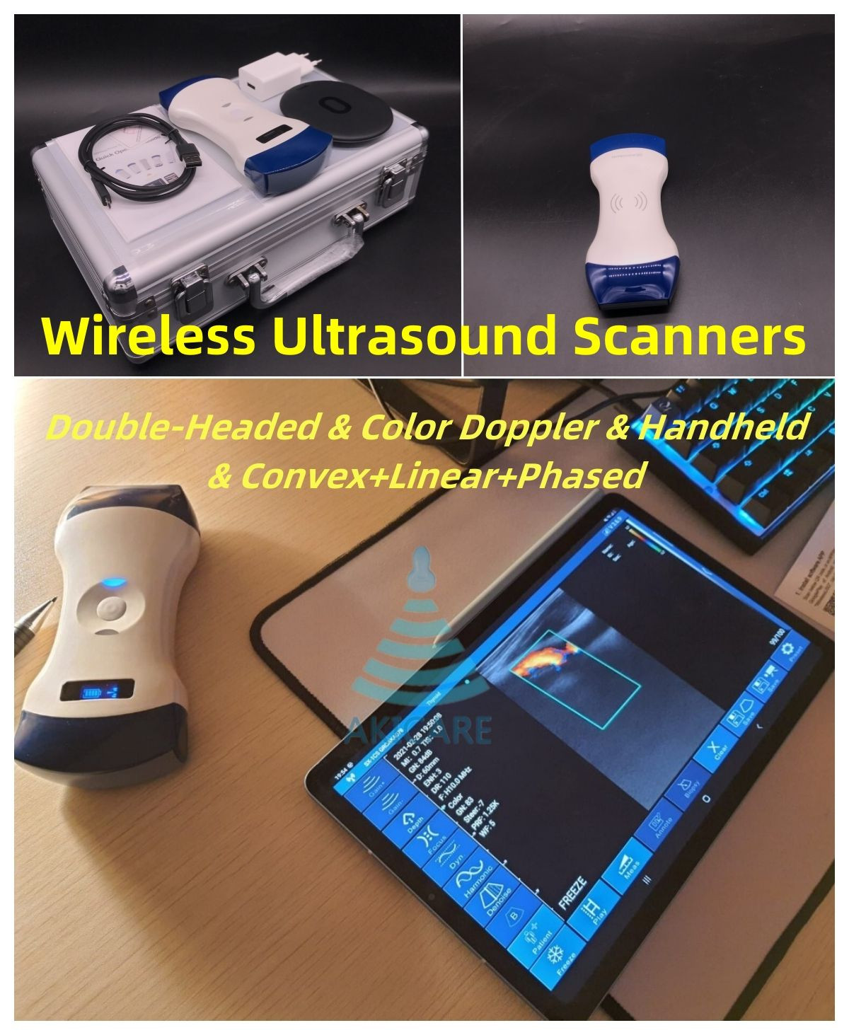 Buy 3 In 1 Wireless Handheld Portable Ultrasound Scanners from Akicare ...