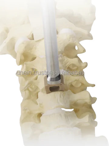 Buy Anterior Cervical Interbody Fusion Cage Device Spine Fixation ...