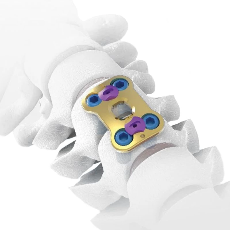 Buy Cervical Plate from Ommedico Technology Co., Ltd, China ...