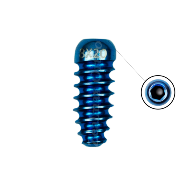 Buy .interference Screw (titanium) from Zealmax Ortho, India ...