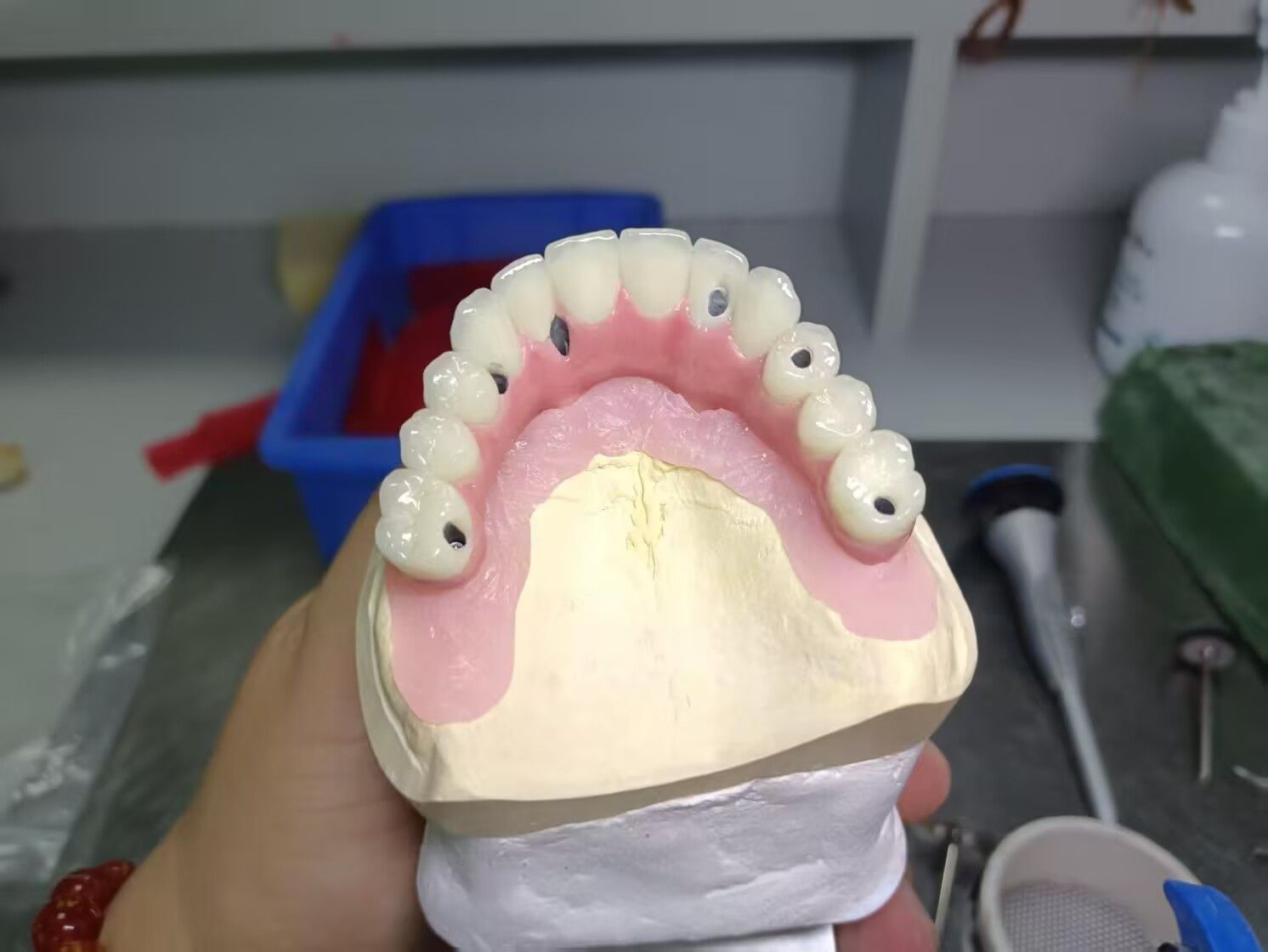 Buy China Screw Implant Crown And Cridge Manufacturers Factory ...