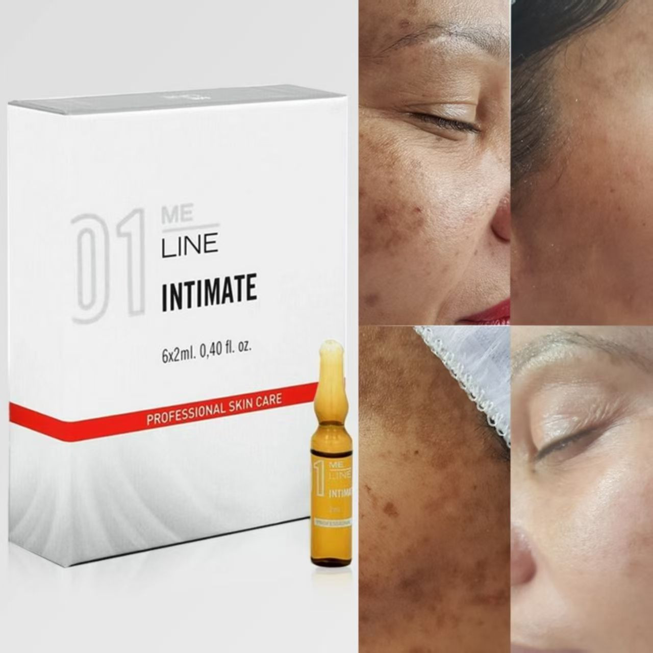 Buy Me Line 01 Reduces Spots Skin Whitening Solves Facial And Body Skin ...