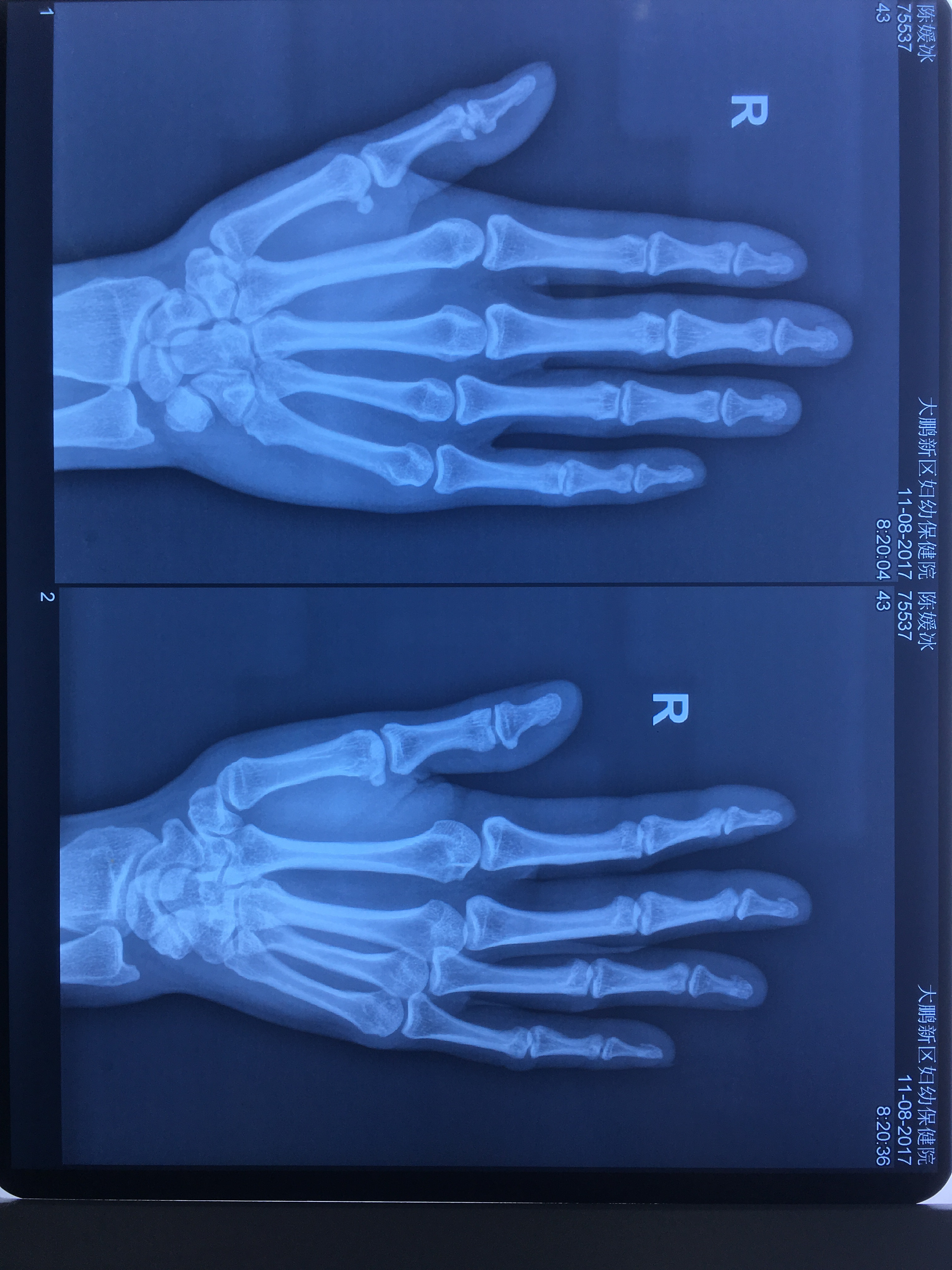 Buy Japan 14x17inch 35x43cm Fuji Di-hl Dihl Laser Film X-ray Medical ...