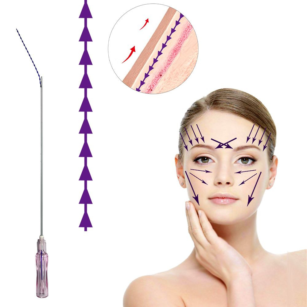 Buy Fishbone Molding Press Cog 4d 6d 360 Lifting Threads from Hebei ...