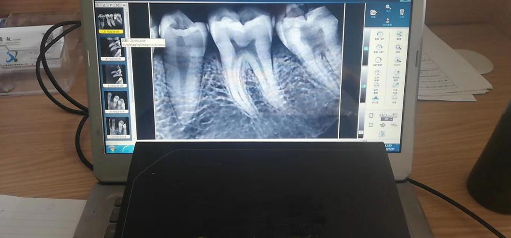 Buy Korea Vatech Rvg Dental X Ray Sensor/intra-oral Imaging Systems ...