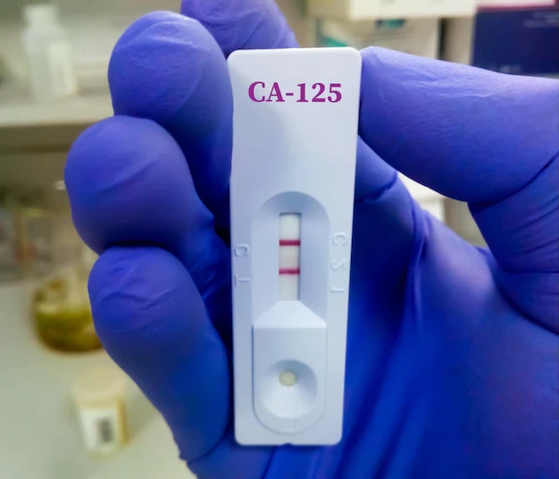 Buy Rapid Test Kits Cancer Marker from SSN Global Solution Pte Ltd ...