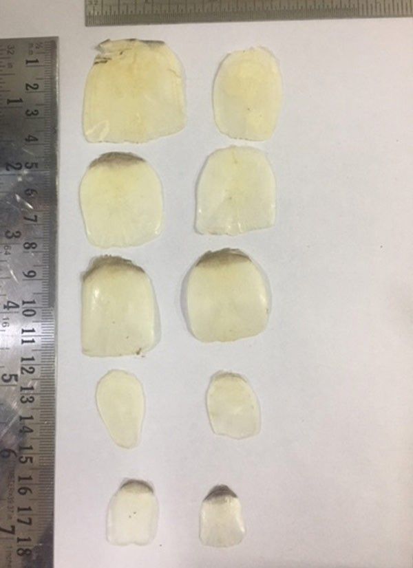 Buy Dry Fish Scales from Nizona Marine Products Private Limited, India ...