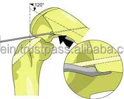 Buy Transtibial Transportal Femoral Aimer Acl Pcl Reconstruction Kinein ...