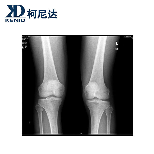 Buy Mri Ct Cr Dr Medical Equipment For Fuji Agfa Digital X-ray Film ...