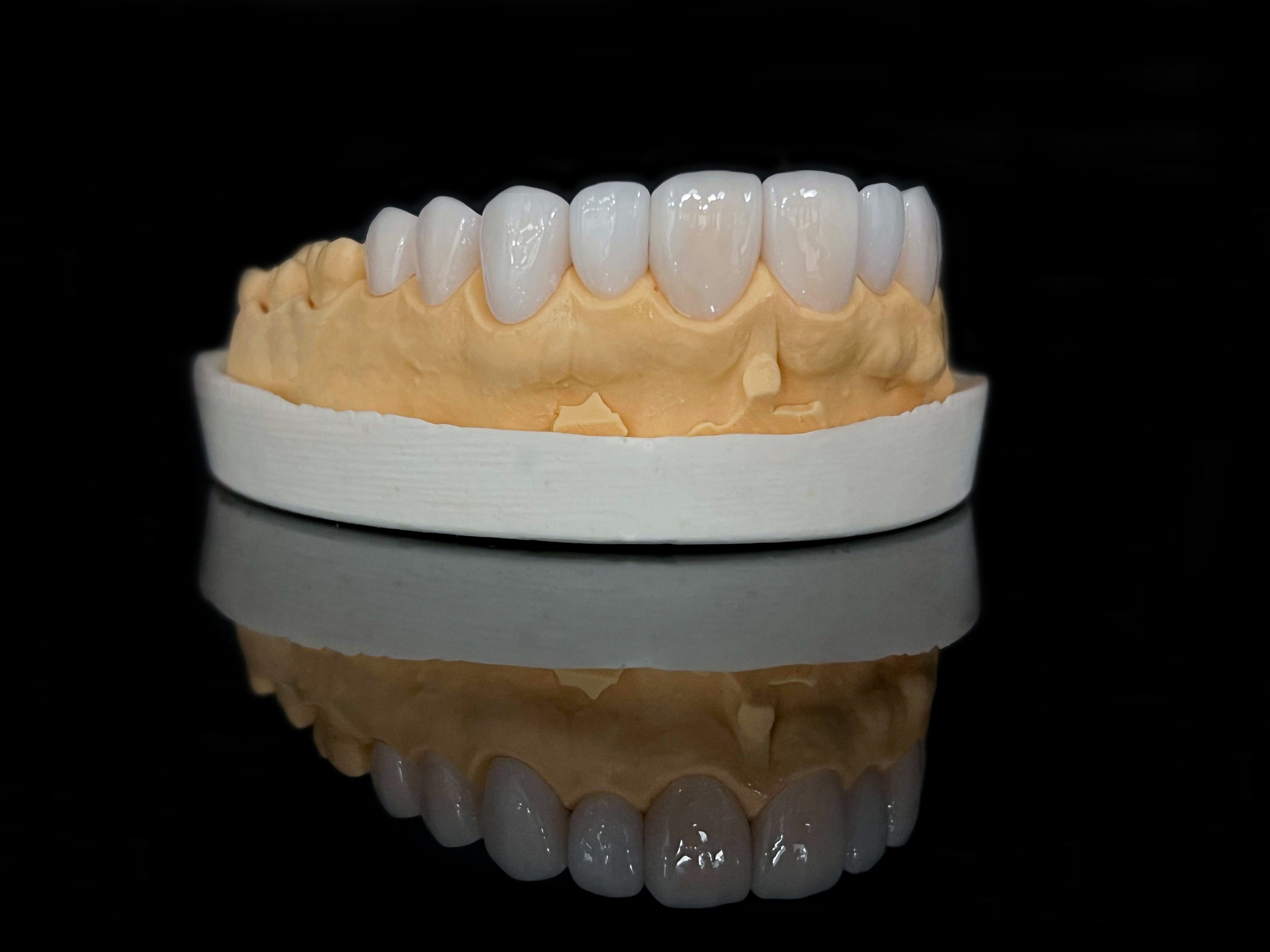 Buy Denture from Shenzhen zhongnan dental lab, China | Tradewheel.com