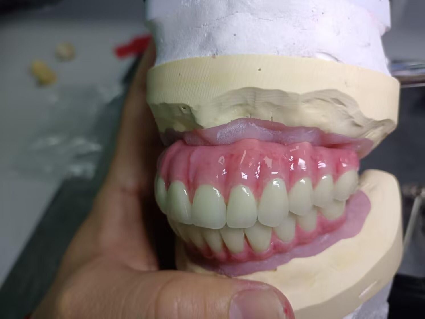 Buy Implant Dental Lab ，dental Implant Lab from Shenzhen Jiusheng ...