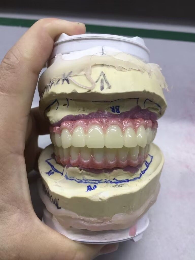 Buy Implant Dental Lab ，dental Implant Lab from Shenzhen Jiusheng ...