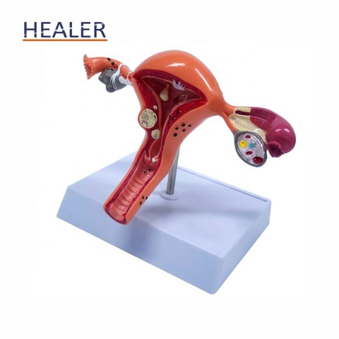 Buy Anatomic Model Of Female Reproductive Organ Uterus Vagina, Female ...