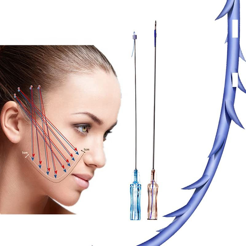 Buy Ultra Face V Lift Thread Pdo Skin Tightening Pdo Pcl Plla Cog Mono ...