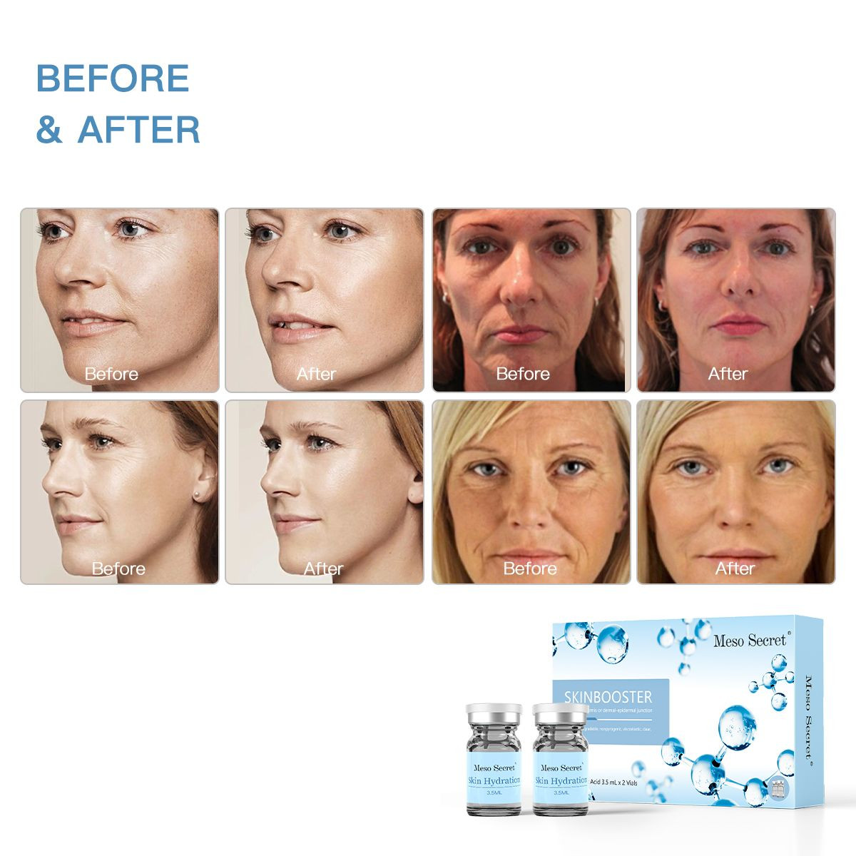 Buy Relieve Sensitive Skin Deep Hydration Long-lasting Skinbooster ...