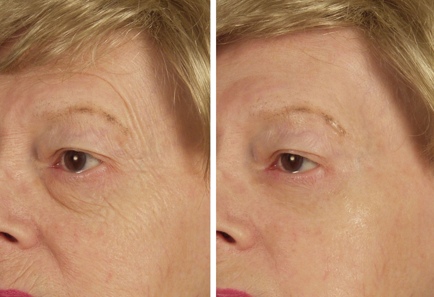 Buy Reverse Instant Wrinkle Remover from Diva Deva Anti-Aging Technology, USA | Tradewheel.com