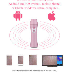 Buy Hand-held Dermoscope,digital Microscope Facial Skin Analyzer, Skin ...