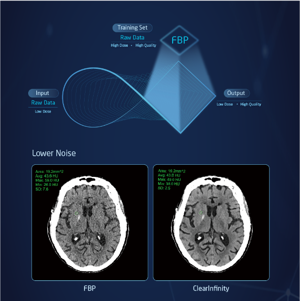 Buy 128 Slice Ct Scanner from Neusoft Medical Systems Co., Ltd., China ...
