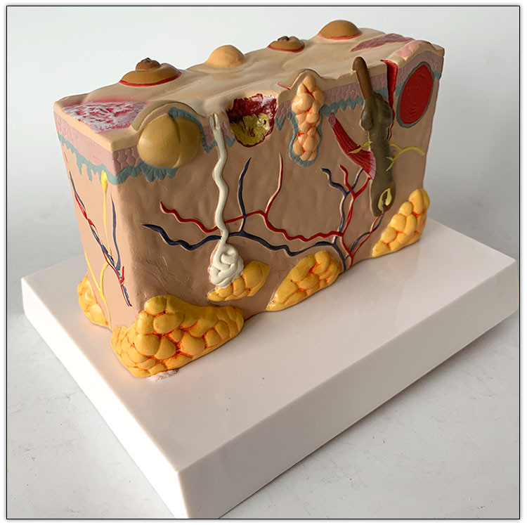 Buy Pathological Model Of Burned Skin Skin Anatomical Model Skin Model ...