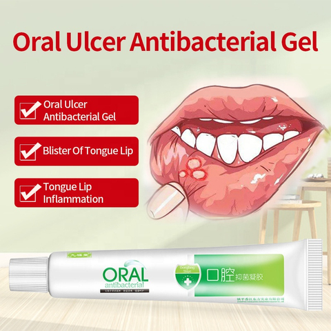 Buy Mouth Ulcer Gel Other Oral Hygiene Products Oral Care Mouth Ulcer ...