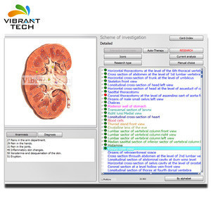 Buy Medical Bioplasm Nls Full Body Analyzer Bioresonance Diagnostic ...