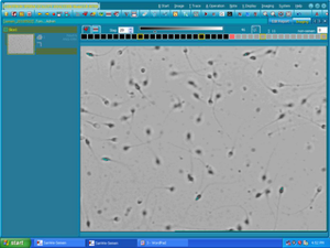 Buy Sw3702 Semen Analysis Machine Clinical Analytical Instruments from ...
