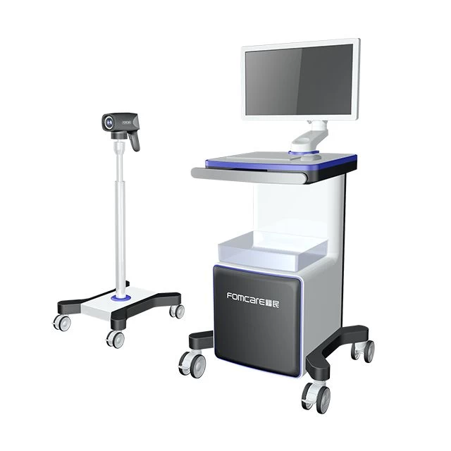 Buy Hd Video Colposcope Camera Video Ventina Digital Colposcopy For ...