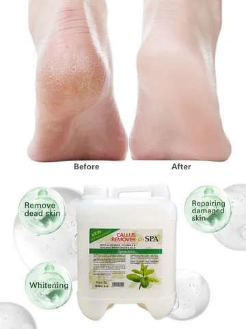 Buy Facial Body Exfoliating Lightening Exfoliating Gel Aloe Vera ...