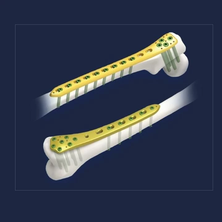 Buy Trauma Plates Iv from Ommedico Technology Co., Ltd, China ...