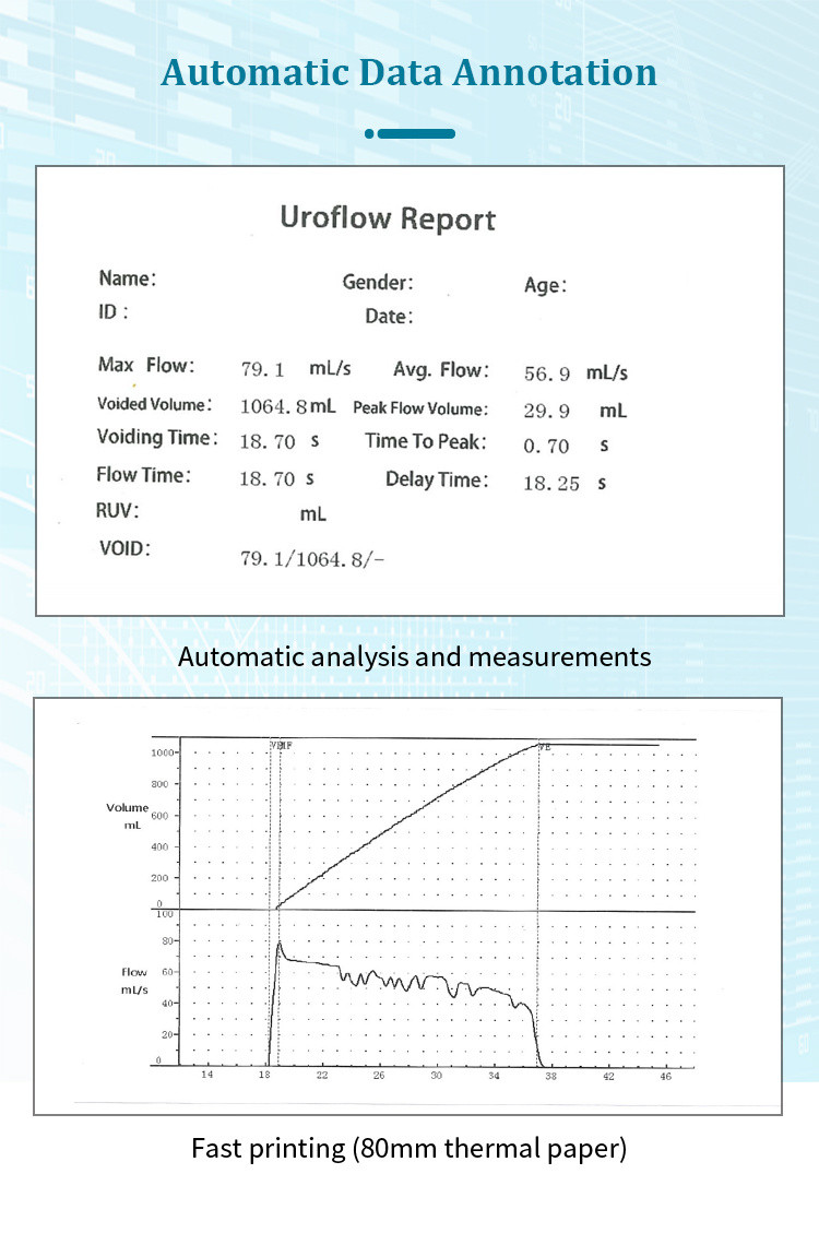 Buy Urology Urine Flowmeter Equipment Pc Series1100ml Stricture ...