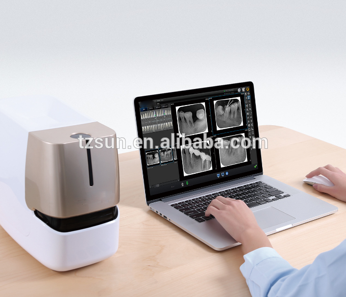 Buy Digital Dental Radiography Imaging System/3d Dental Image Phosphor ...