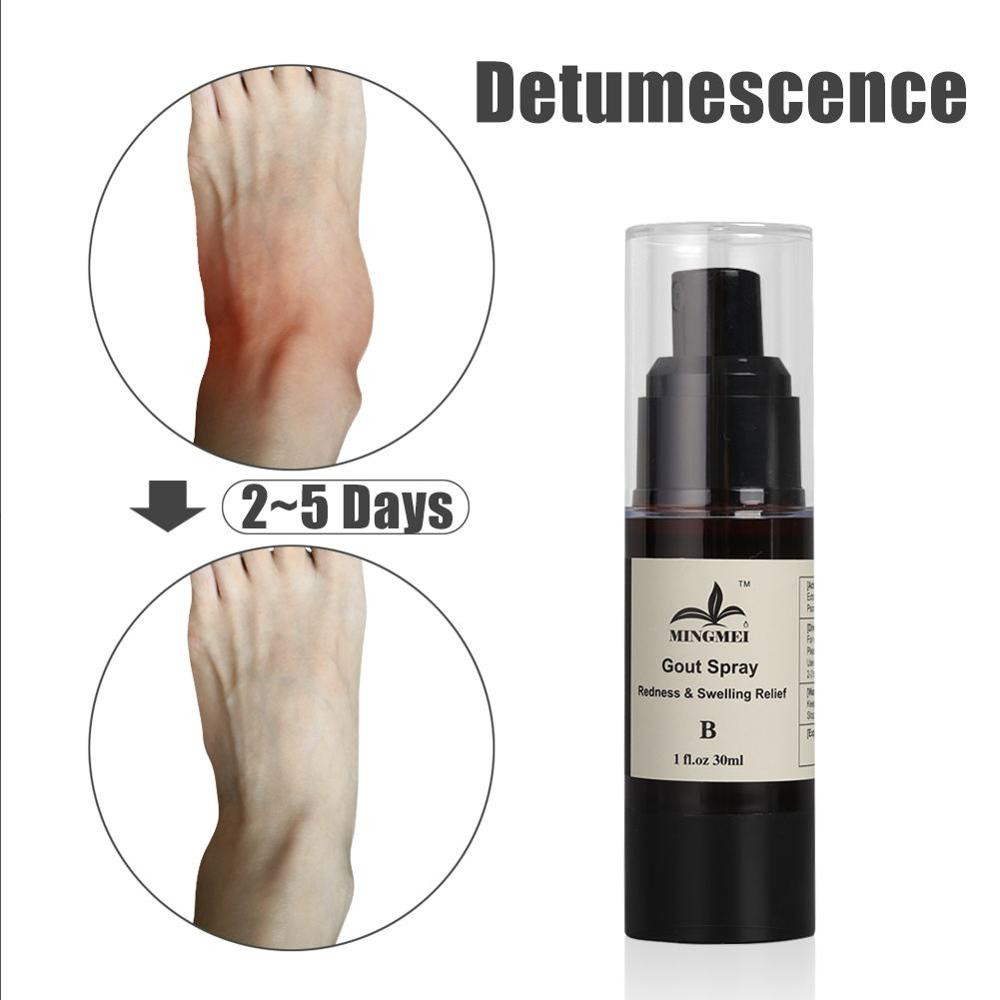 Buy Gout Analgesic And Swelling Formula Spray, Natural And Home ...