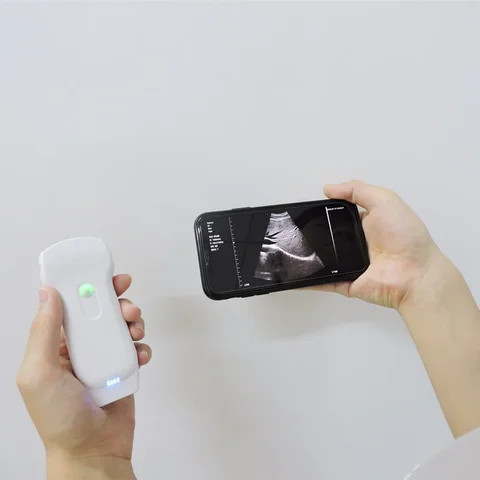 Buy Wifi Wireless Ultrasound Scanner With Double Head Mini Color ...