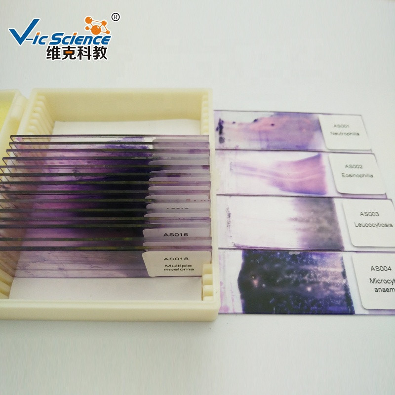 Buy 18pcs Glass Blood Smear Histology Human Microscope Biology ...