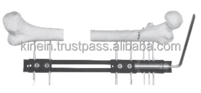 Buy Rail Fixator Lrs Limb Reconstruction Limb Lengthening External ...
