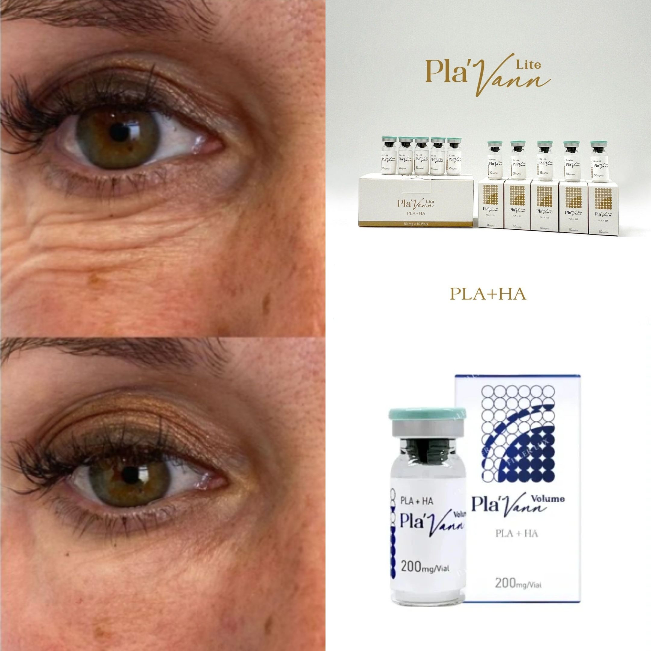 Buy Korea Plla Plavan Lite 50mg Volume 200mg Collagen Stimulator ...